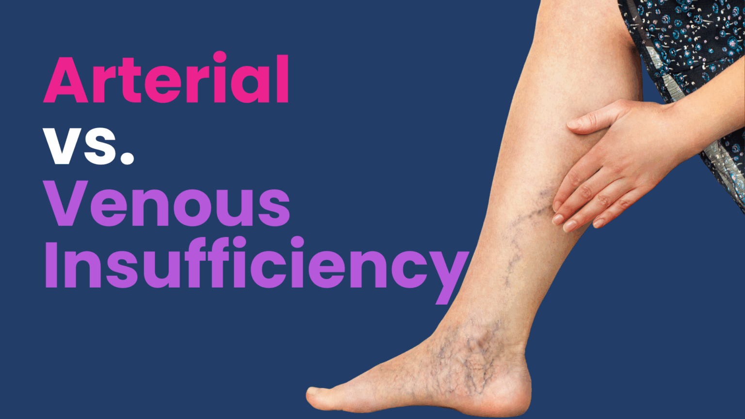 Arterial vs. Venous Insufficiency | Florida Vein Experts